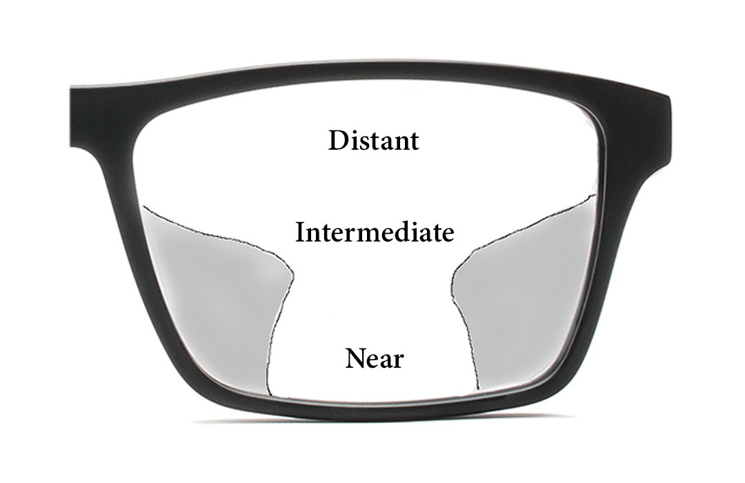 Opto Digital BRP 1.56 Index (Progressive Lens) – WIDE CORRIDOR ...